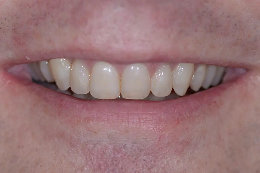 Orthodontie - GAAF Mondzorg: Tandarts & Orthodontie Enschede